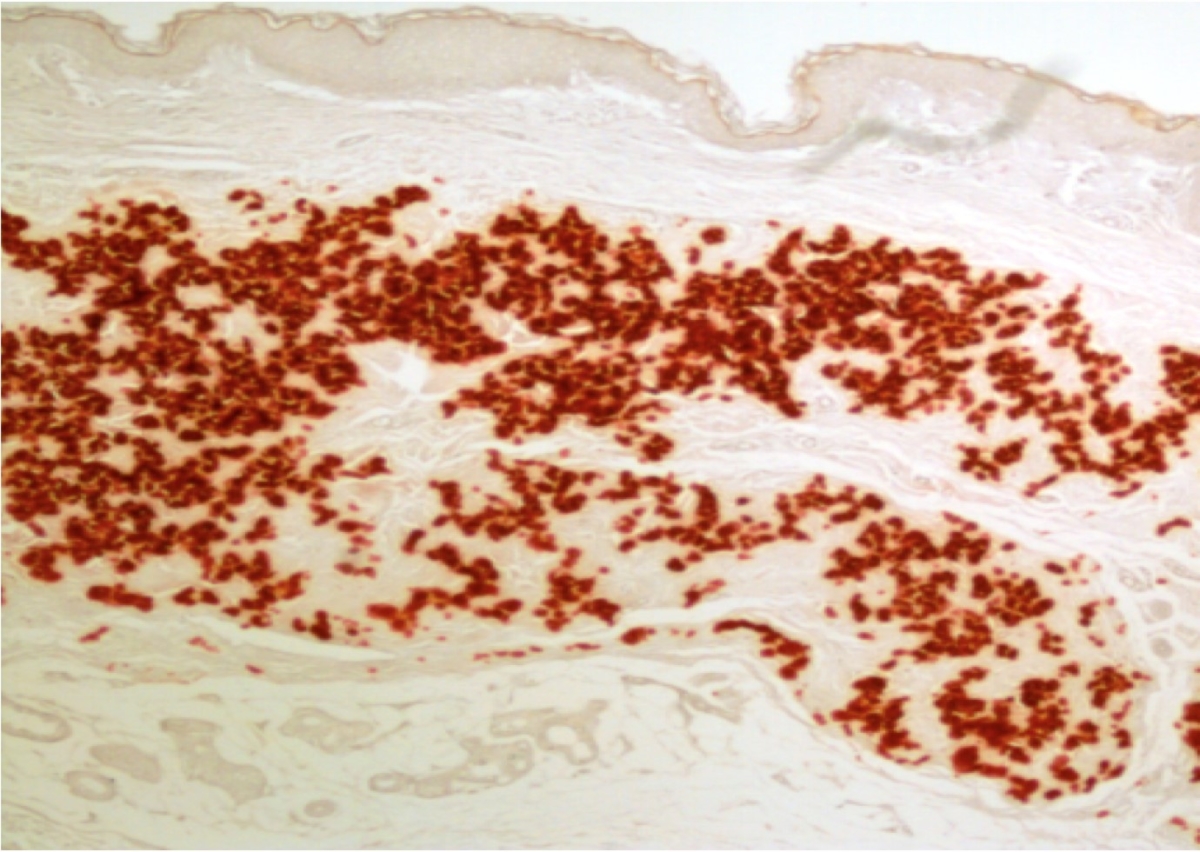 The Hard Science of Making Us Softer: EuroSoftCalcNet