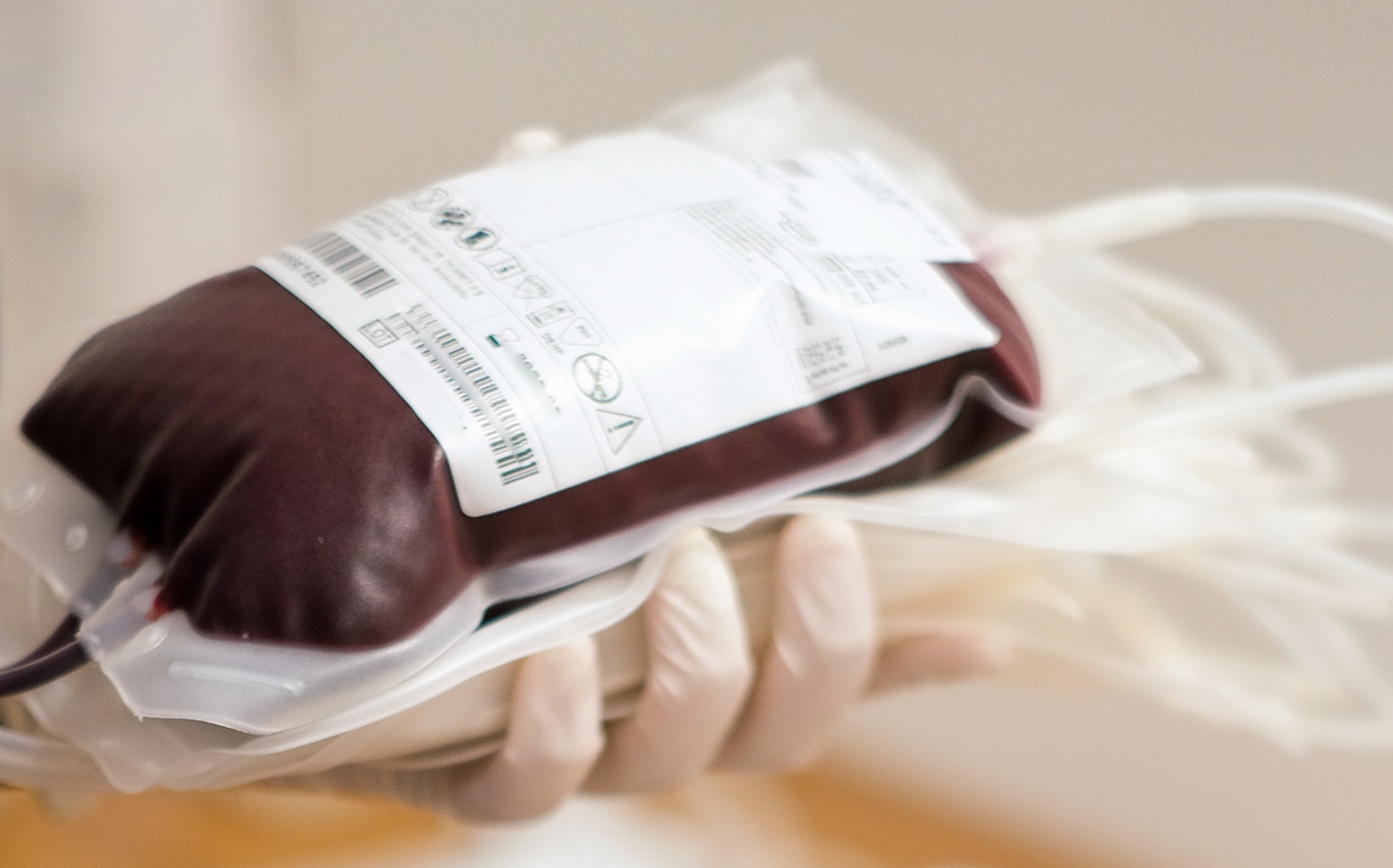 Kidney Exchange Programmes and COST Action innovations