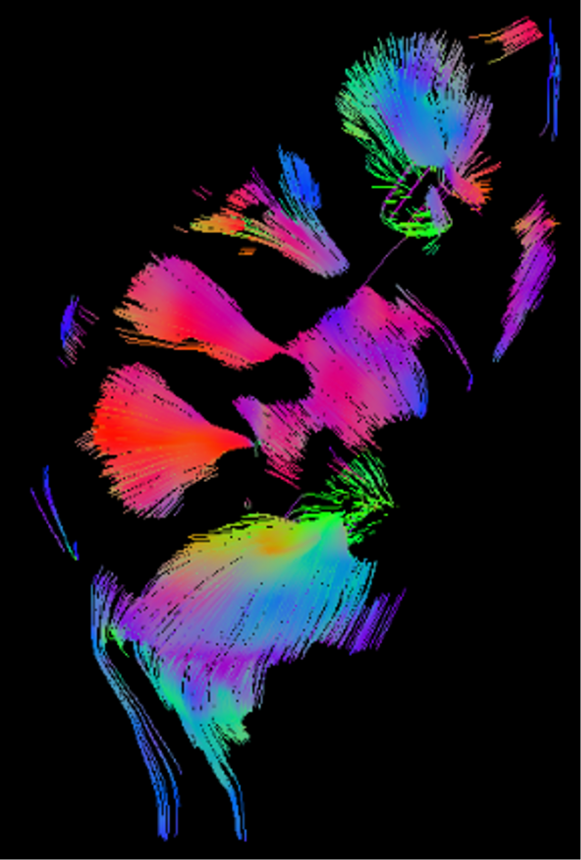 Imaging chronic kidney disease with PARENCHIMA