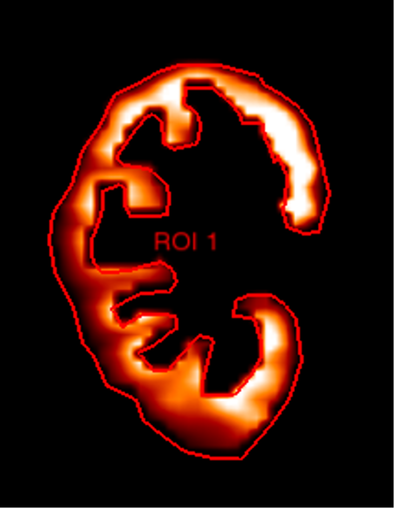 Imaging chronic kidney disease with PARENCHIMA